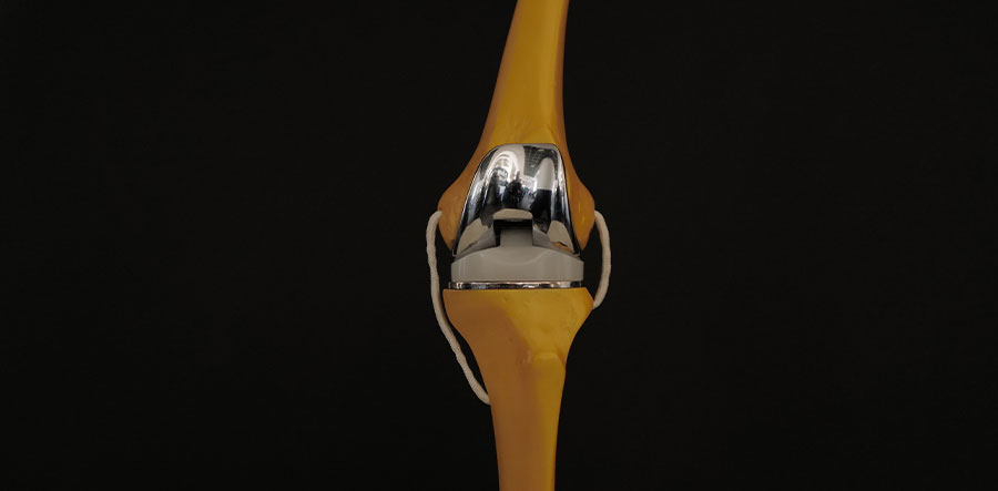 Genou – DR. DIDIER D'HONDT